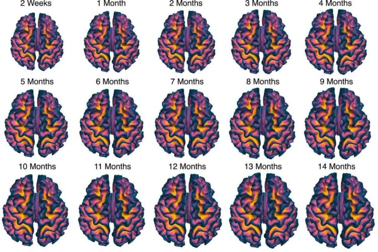 Nuevo atlas del cerebro infantil mes a mes